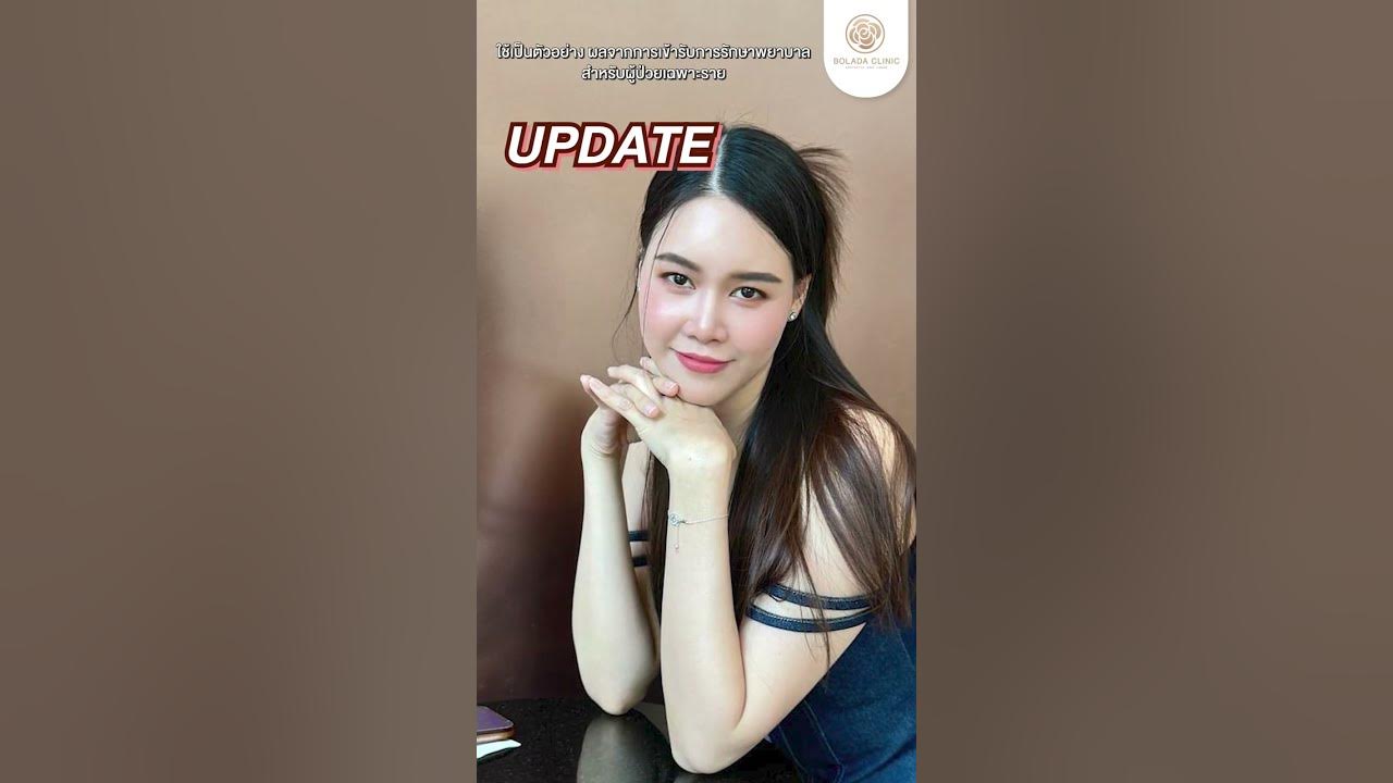 Pico MLA Focus หัวใหม่ดียังไง - YouTube