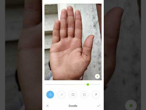 Mole on thumb क्या फल मिलता है? #sarkar palmistry - YouTube