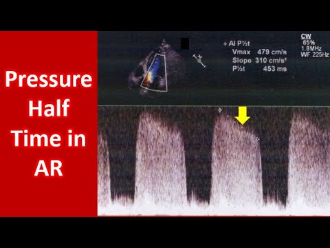 Pressure Half Time in AR - YouTube