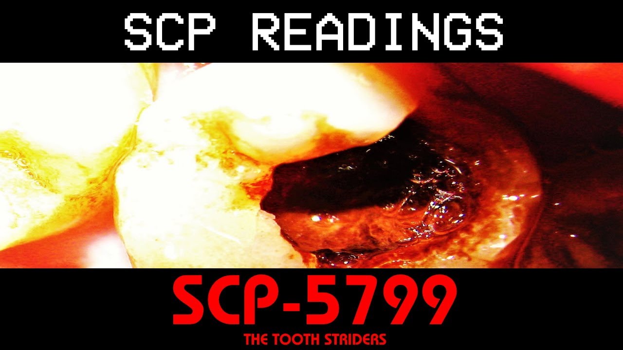 SCP-5799 - The Tooth Striders - YouTube