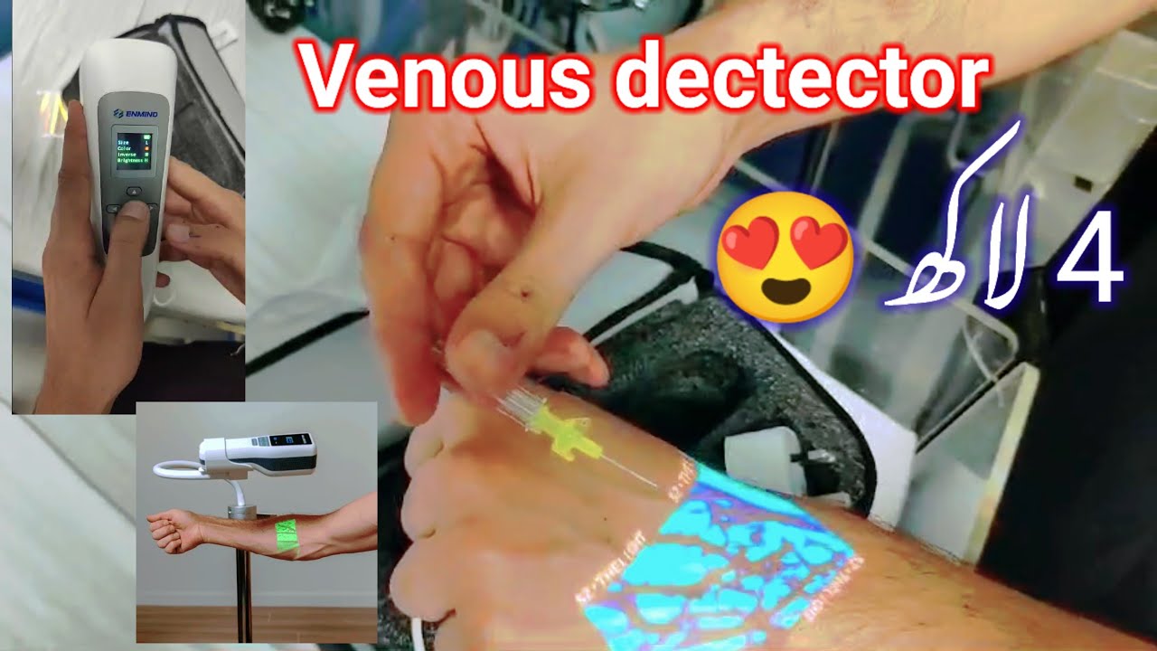 Venous Detector $10000 💵 😍 veins viewer || pediatric vein finder ...