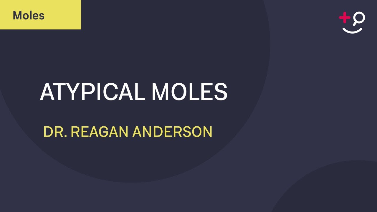 Atypical Moles What Are They Dermatology 2019 YouTube atypical-moles-what-are-they-dermatology-2019-youtube