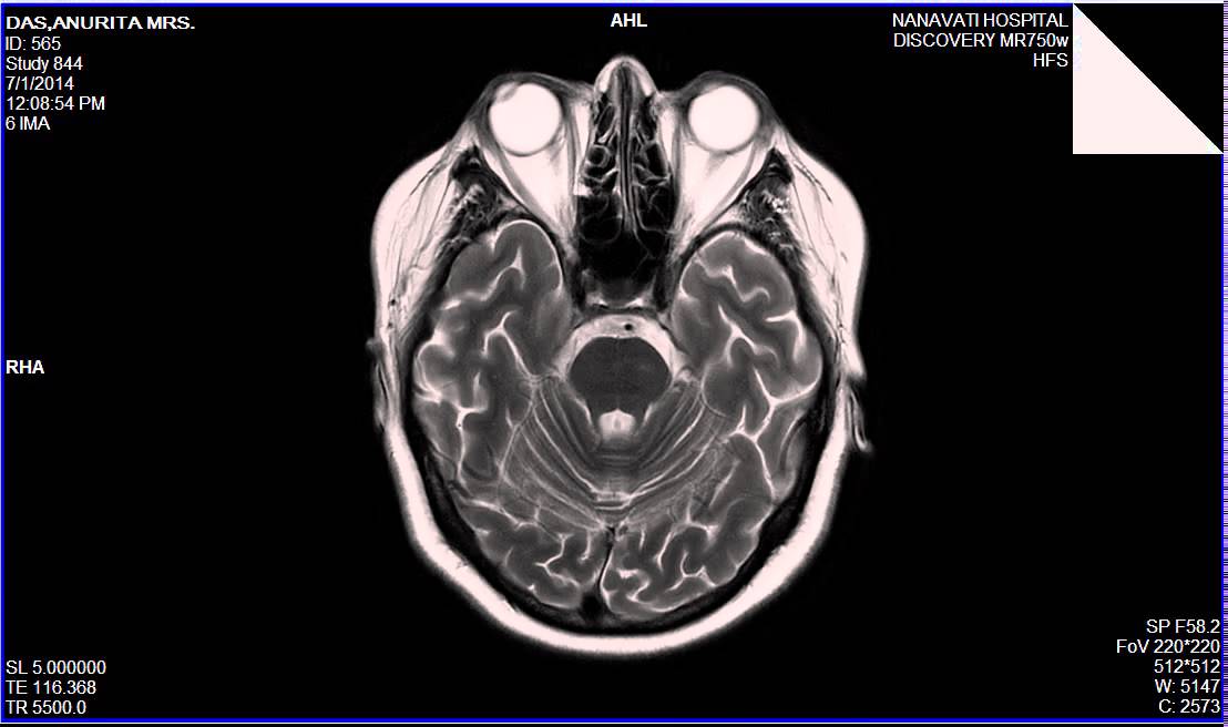 AX T2 Propeller 02nd July 2014 - YouTube