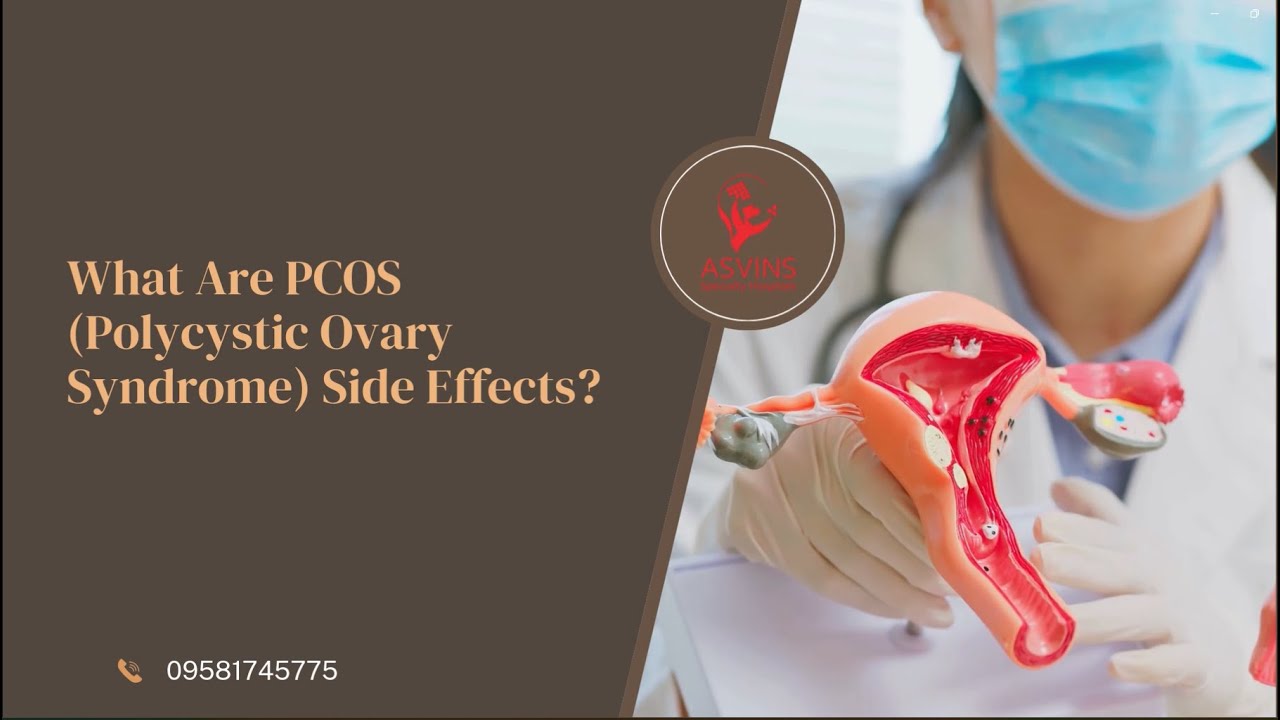 What Are PCOS Polycystic Ovary Syndrome Side Effects - YouTube