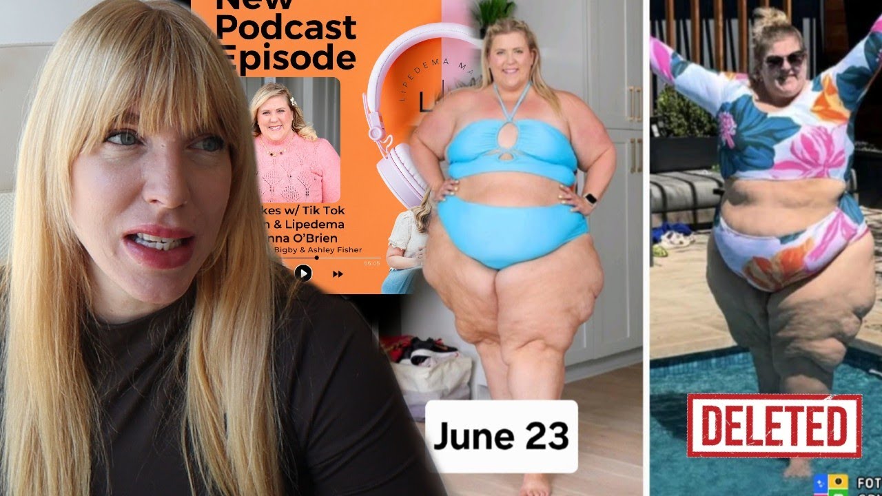 BodyBuilder React To Glitter&Lazers DELETED After Picture Where She Looks Bigger Than BEFORE ...