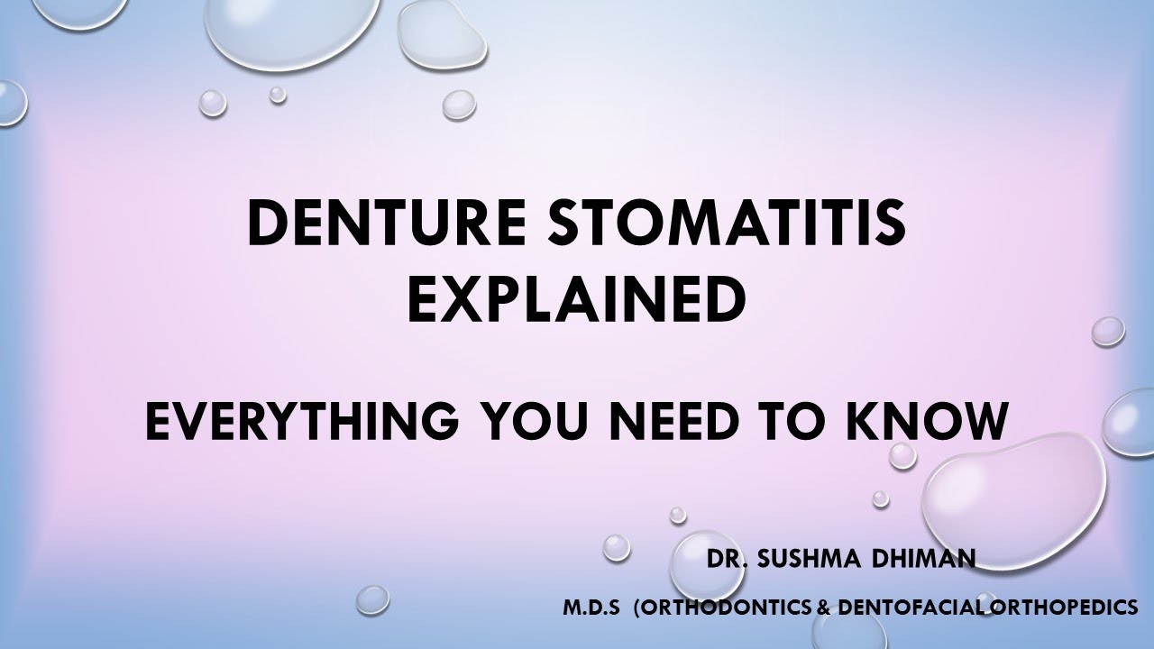 Denture Stomatitis: Causes, Symptoms, and Treatment Explained - YouTube