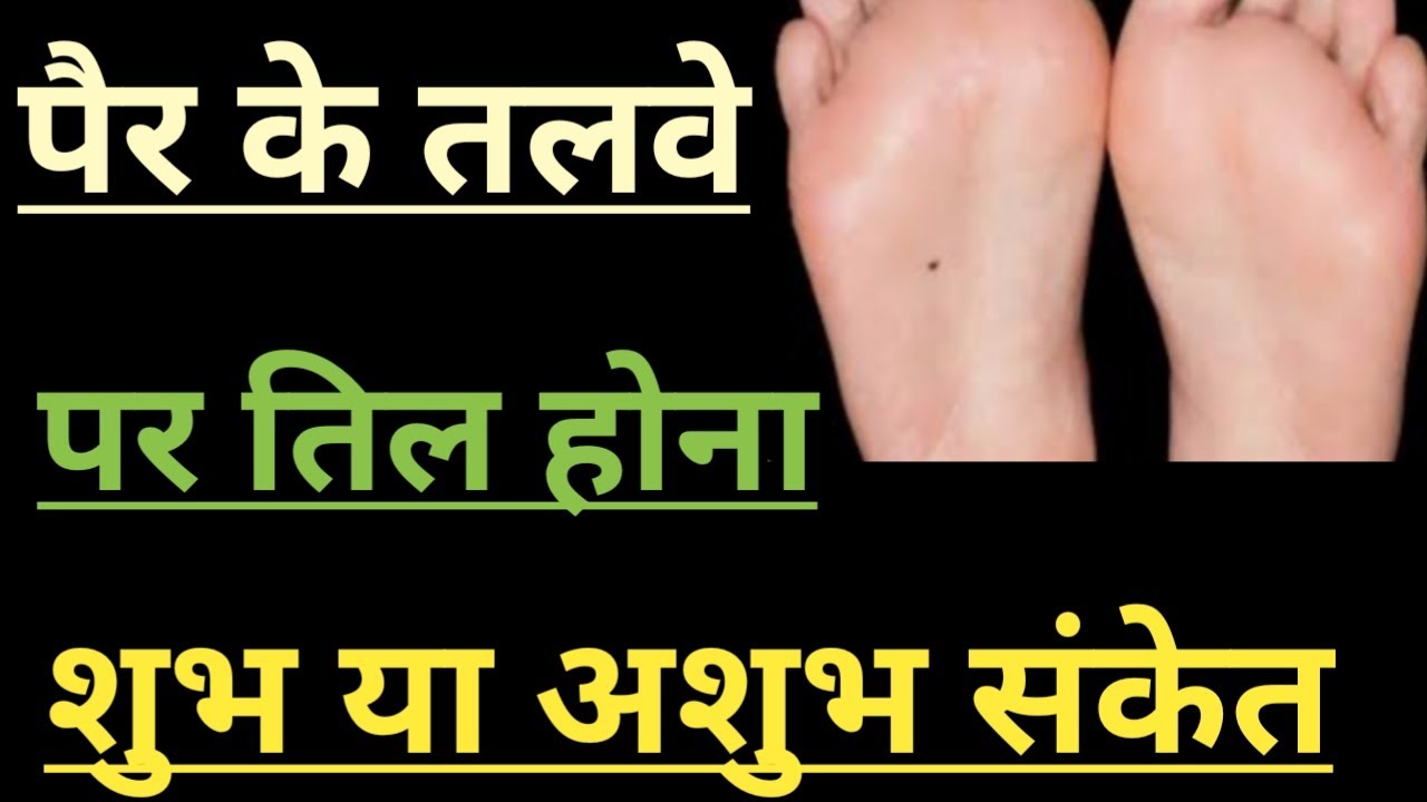 पैर के तलवे पर तिल होने का मतलब है l pair ke talve par til hone se kya ...