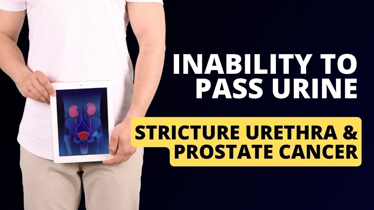 Men s Health Matters Inability To Pass Urine Stricture Urethra And men-s-health-matters-inability-to-pass-urine-stricture-urethra-and