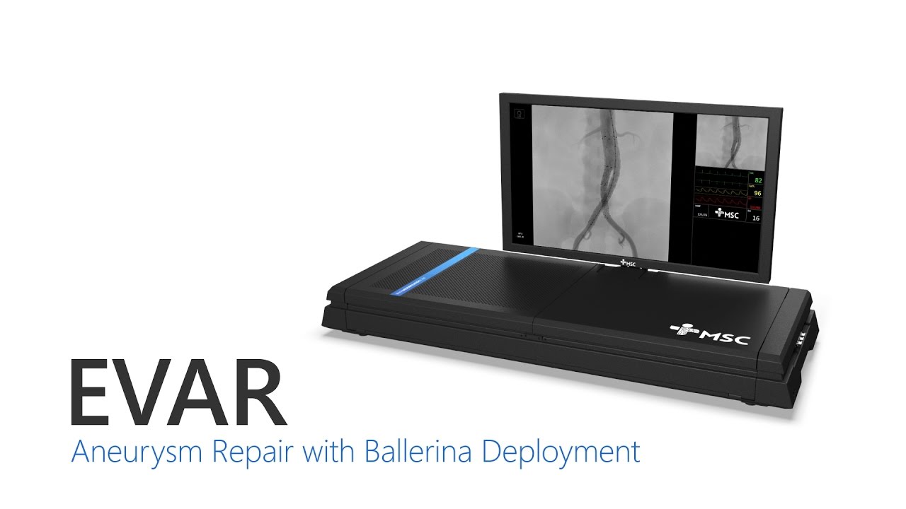 Endovascular Aortic Repair (EVAR) - YouTube