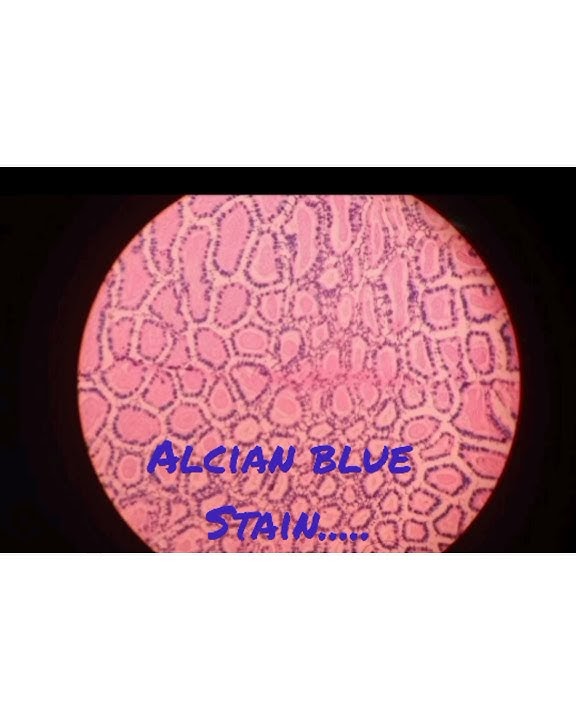 pathology || IHC || Special stain || stain : Alcian blue stain - YouTube