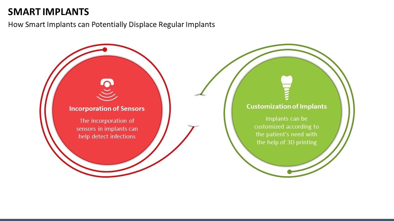 Smart Implants Animated Presentation - YouTube