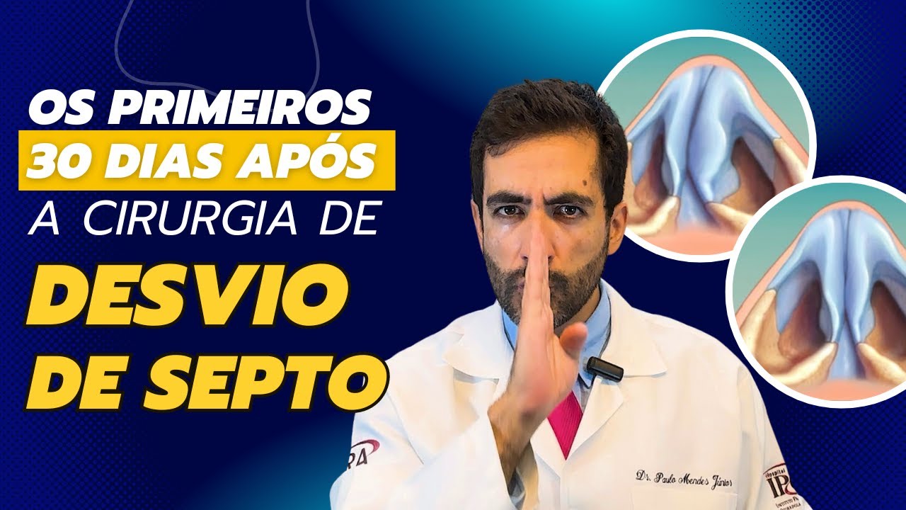30 dias após cirurgia do septo nasal: O que você PRECISA saber - YouTube