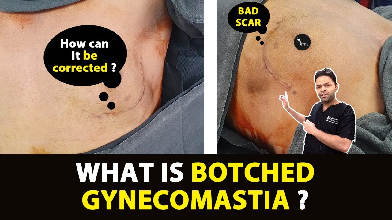 Patient Treated in Government Hospital | Big Scar in Botched ...