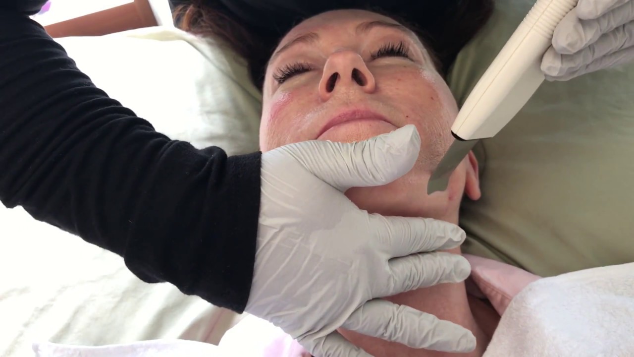 Dermasound UltraSonic Facial - YouTube