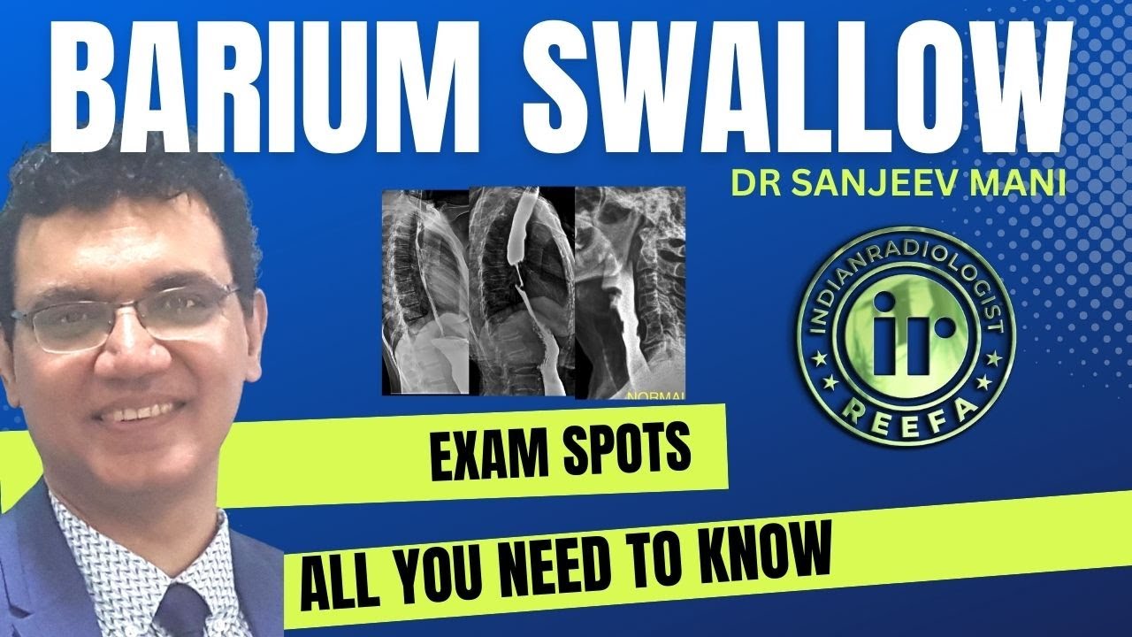 BARIUM SWALLOW - TECHNIQUE | VARIANTS | PATHOLOGIES || DR SANJEEV MANI ...