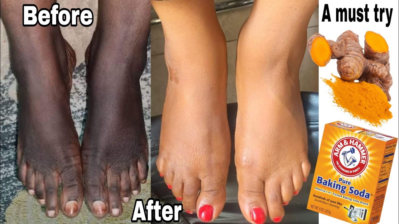 I Cleared My Leg Wrinkles & Damage leg | To Get clear brighter smooth ...