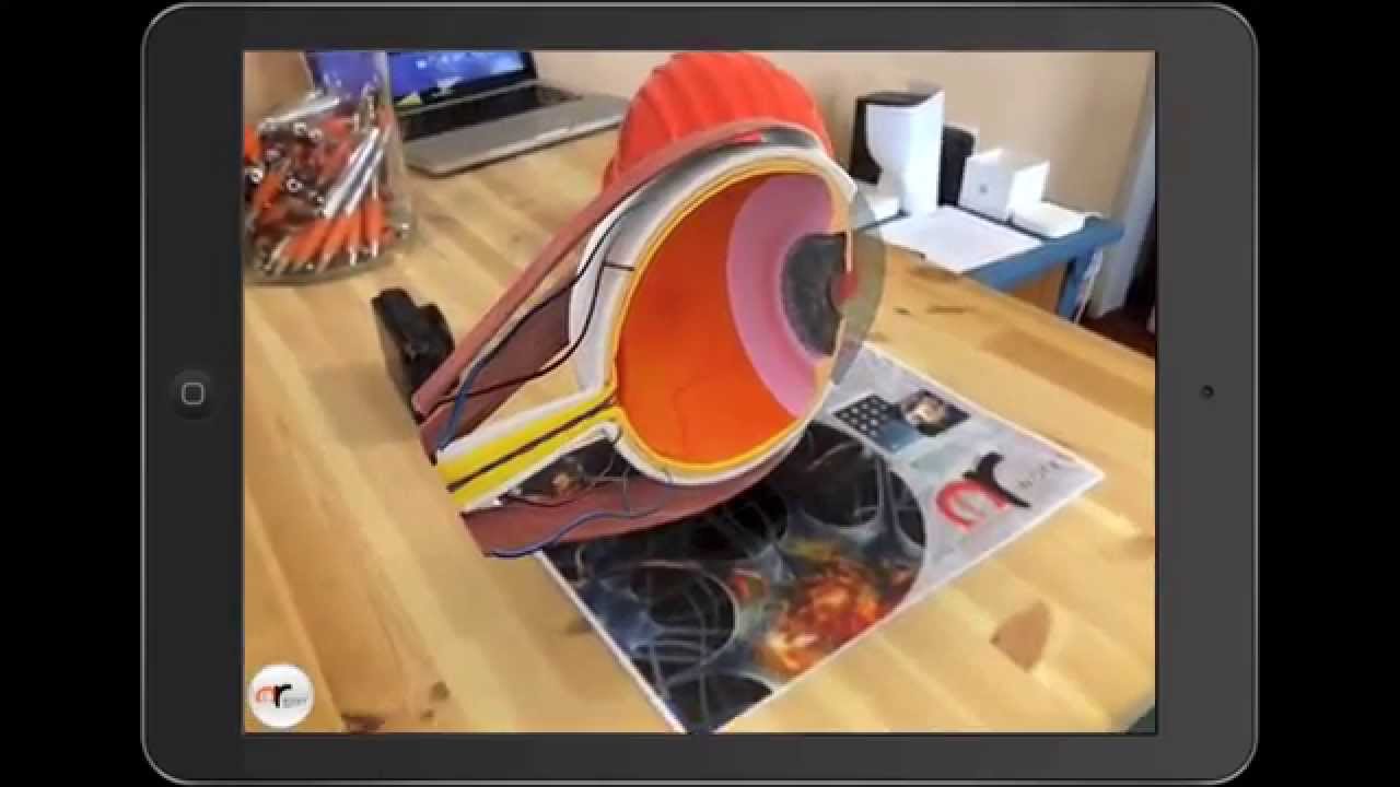 Medical Augmented Reality by ARworks - YouTube