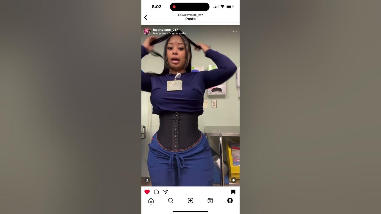 LIPO360 ONLY ! 2 MONTHS POST OP w compression method #lipo - YouTube