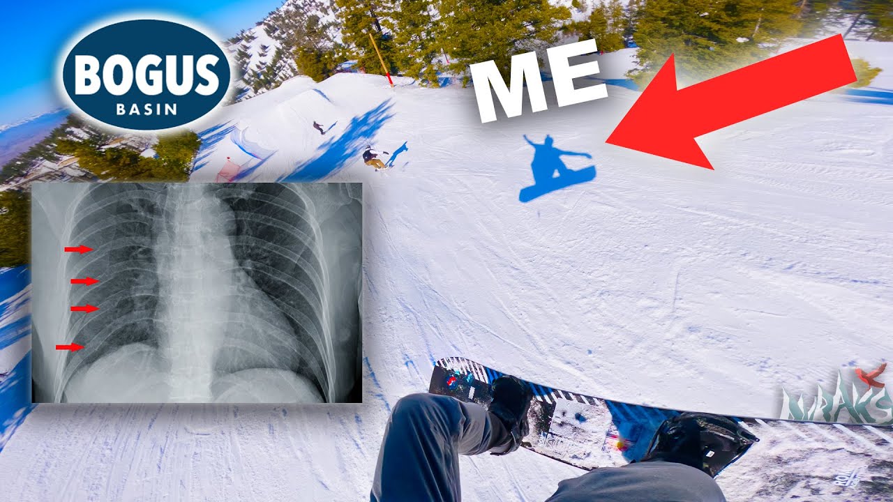 POV: THE WORST FALL I'VE EVER HAD | Bogus Basin - YouTube