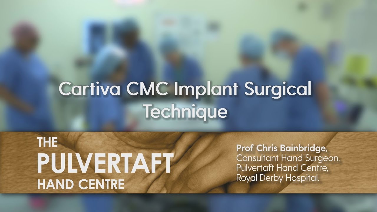 Instructional video for Cartiva CMC implant - YouTube