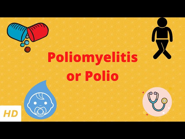 Poliomyelitis