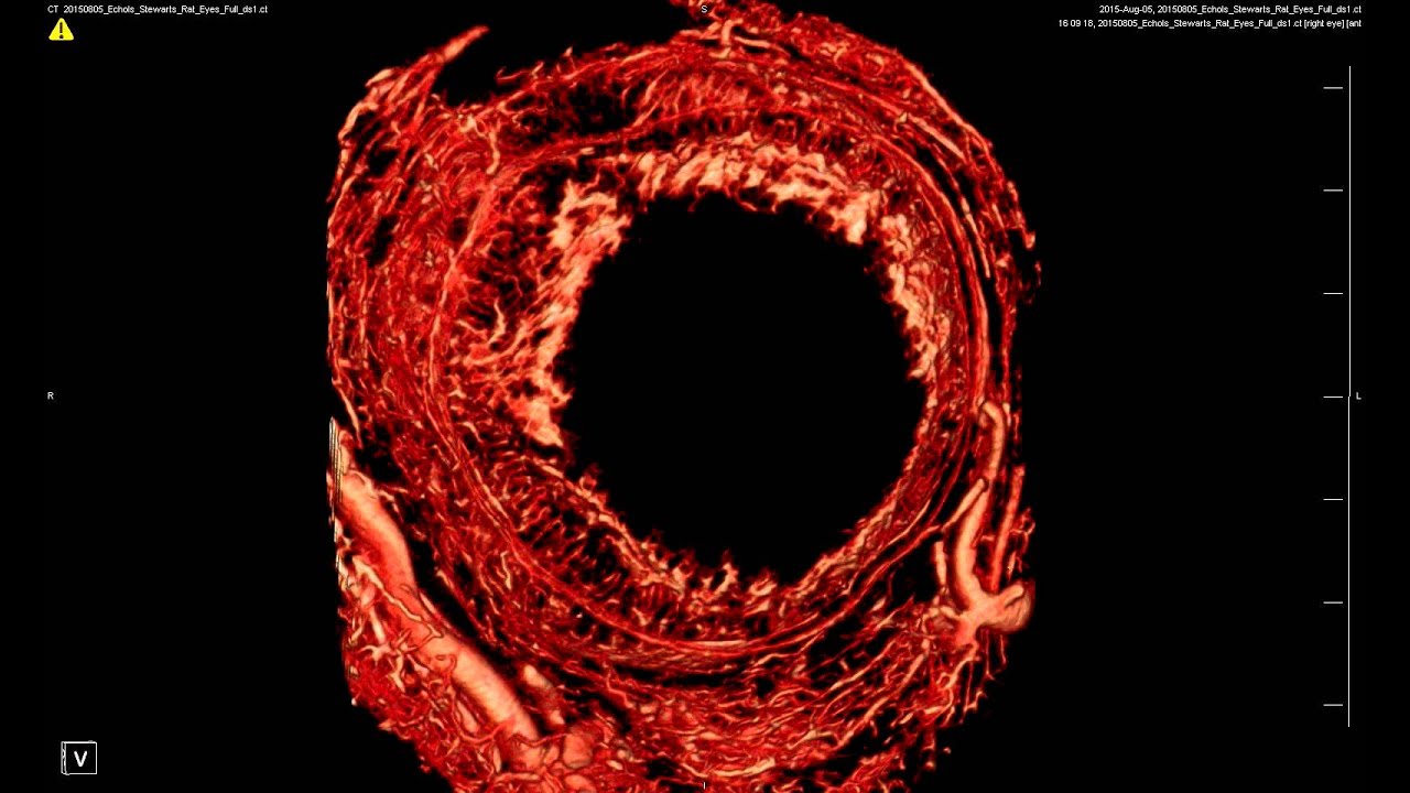 rat eye anterior chamber rotation color - YouTube