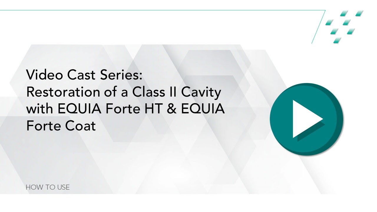 Step-by-Step: Restoration of a Class II Cavity with EQUIA Forte HT ...