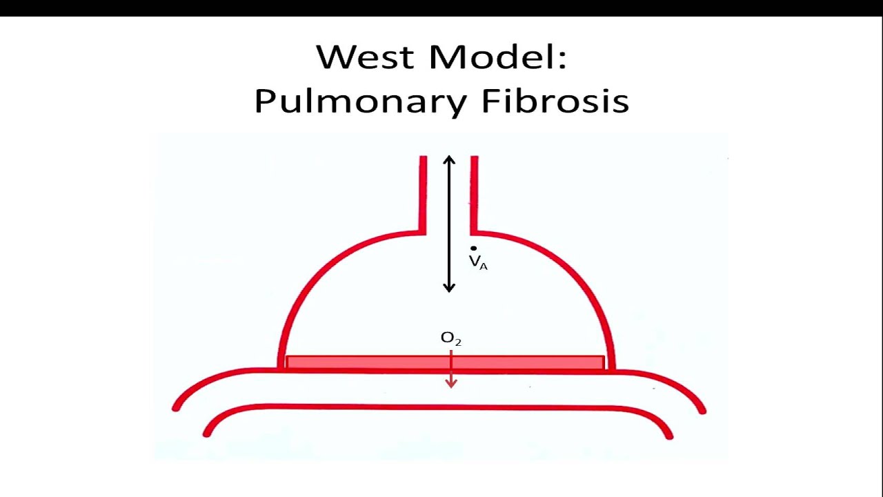 Diffusion Impairment - YouTube