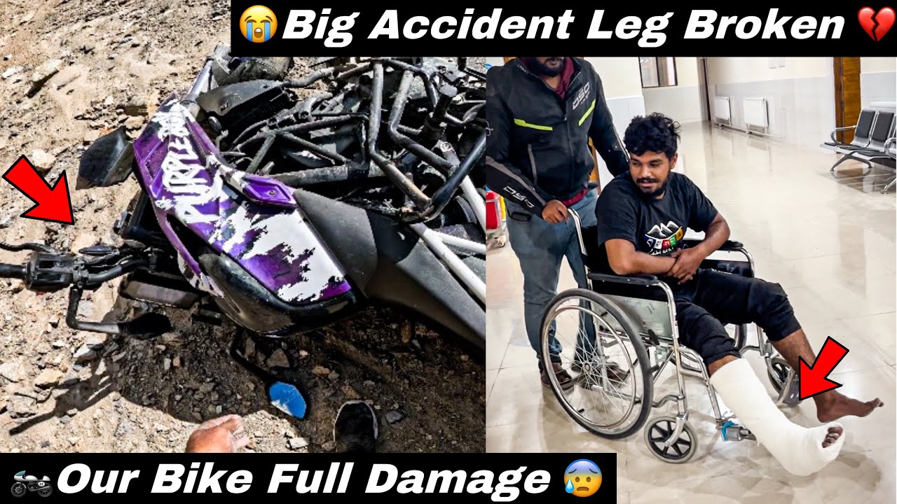 😭Big Accident Leg Broken💔| Episode -33 | 🏍️Our Bike Full Damage 😰| 6 ...