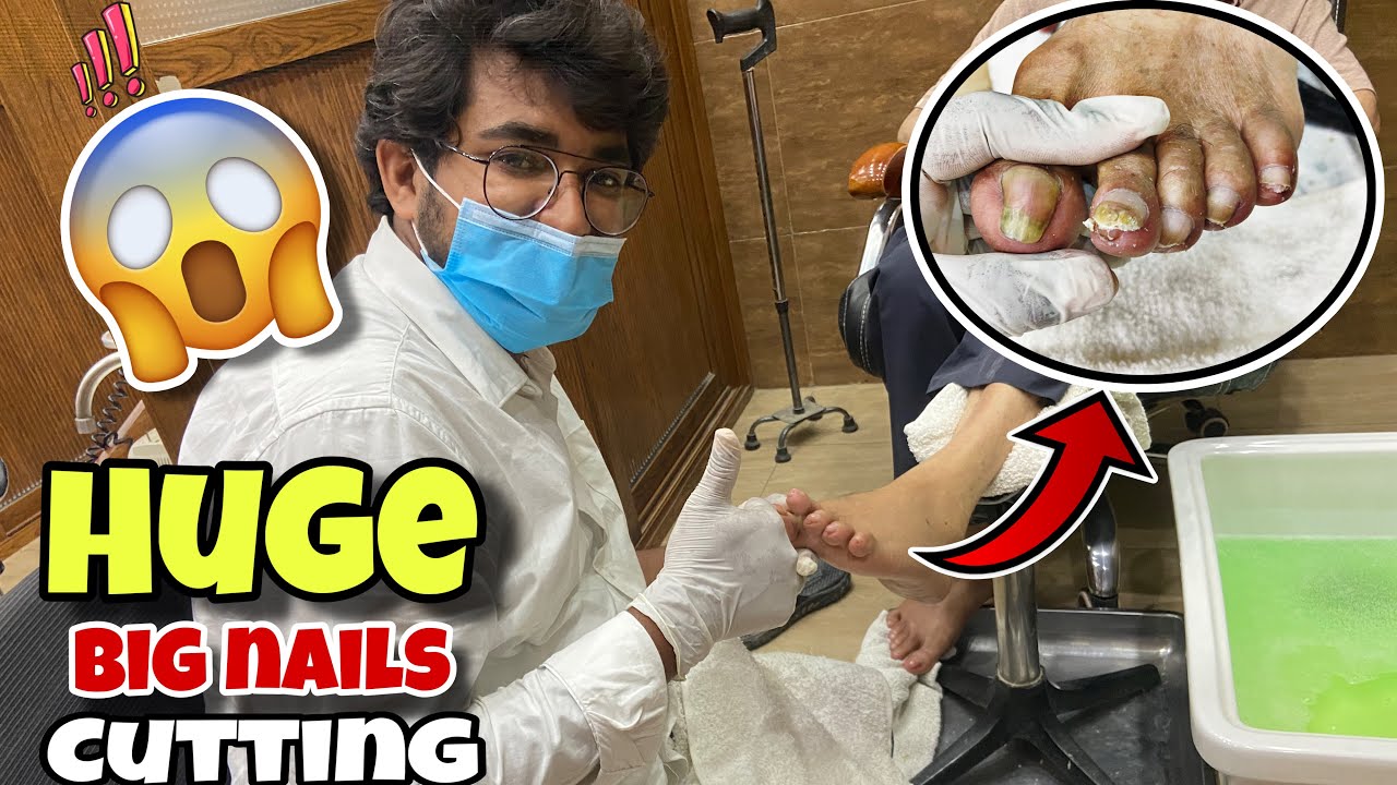 Huge Big Nails Cutting: Tips and Techniques for Safe and Easy Nail ...