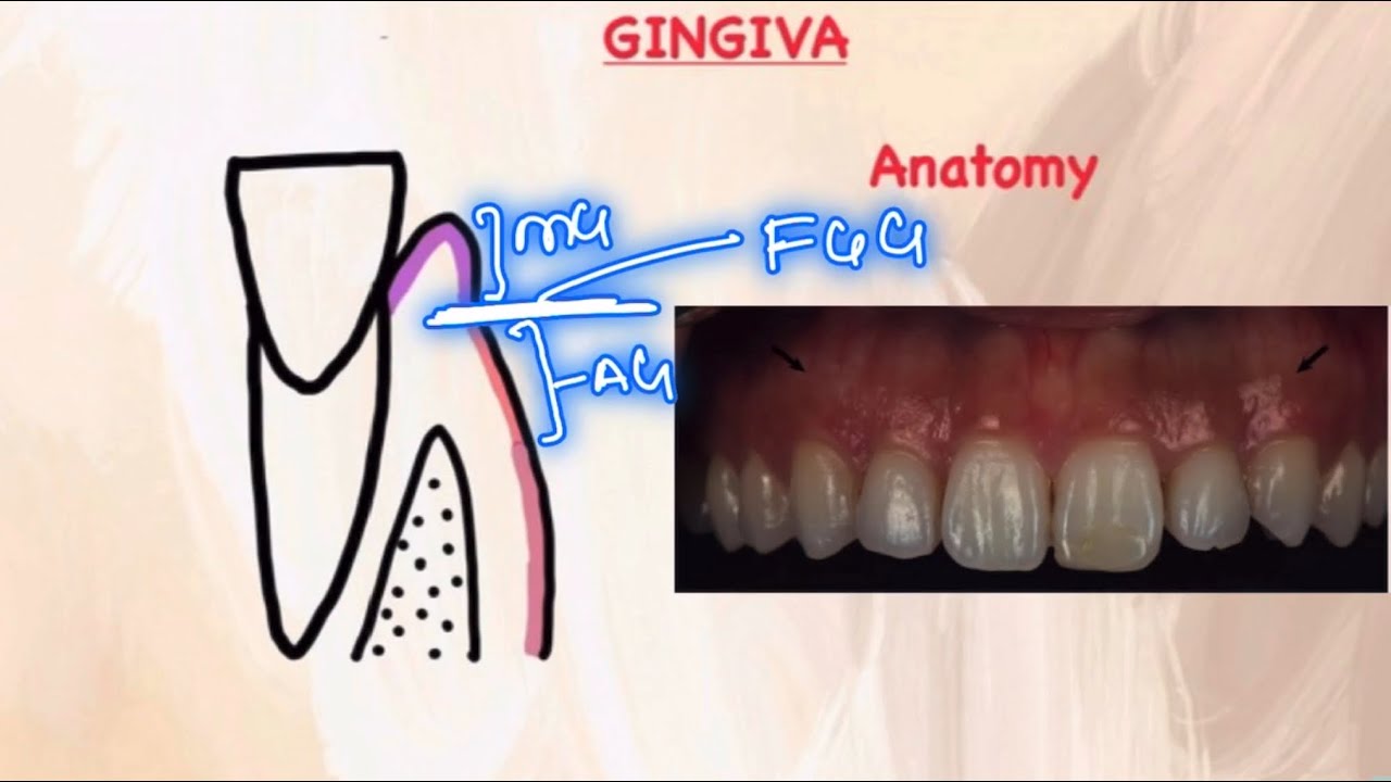 GINGIVA I Anatomy l Macroscopic features I Dental l Carranza - PART 1 ...