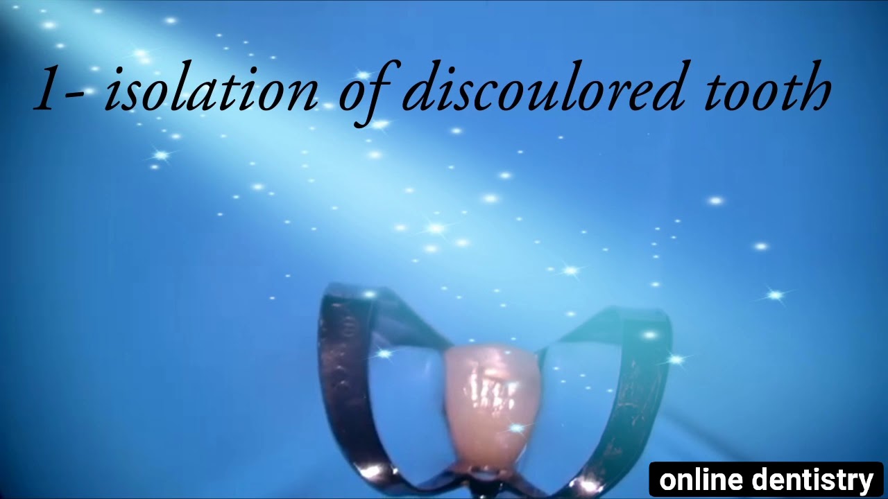 walking bleaching #non-vital bleaching #endo bleaching - YouTube