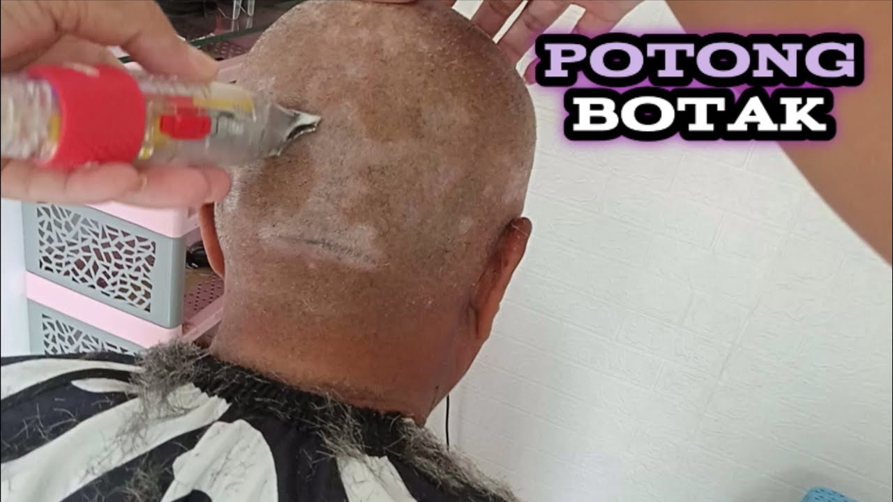Potong rambut botak | kena penyakit kulit sampe segitunya - YouTube