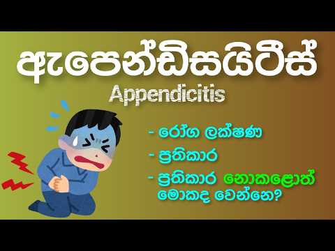 පෙකණිය වටෙන් පටන්ගන්න කැකුම බඩේ දකුණු පැත්තෙන් යටට යනවද? | Appendicitis ගැන හැමදේම සිංහලෙන්