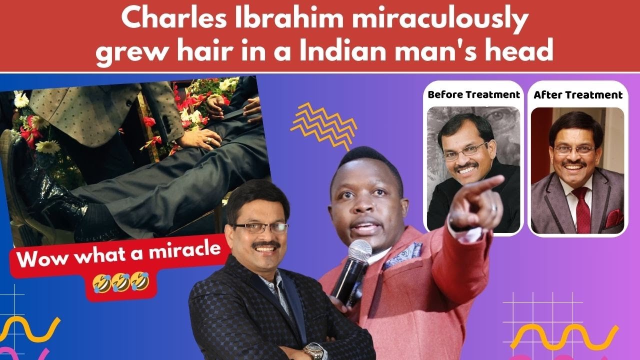 South African preacher Charles Ibrahim miraculously grew hair in a ...