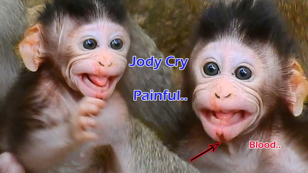 Sorrowly Baby Jody Cries Pain On His Chin | What Happened On Jody ?Jody ...