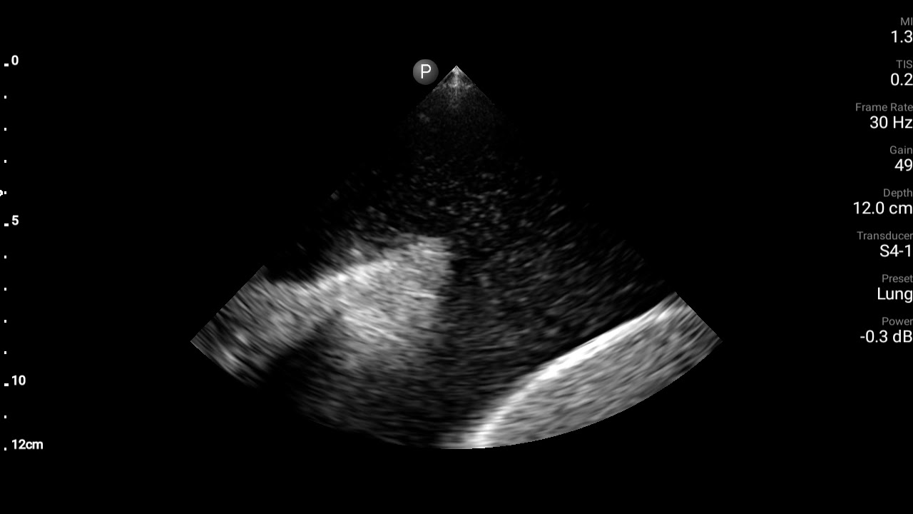 Plankton sign - YouTube