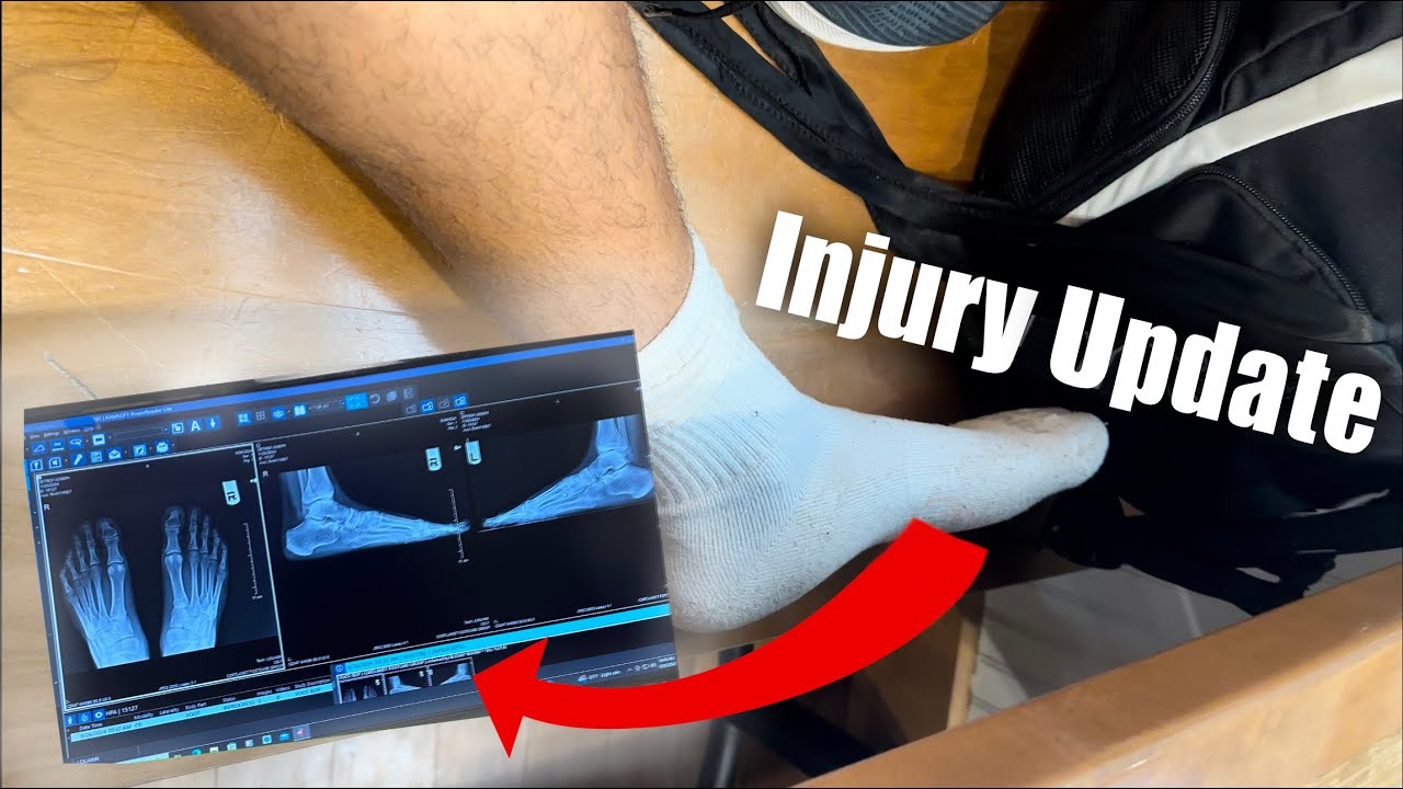 Update: Foot Injury - YouTube