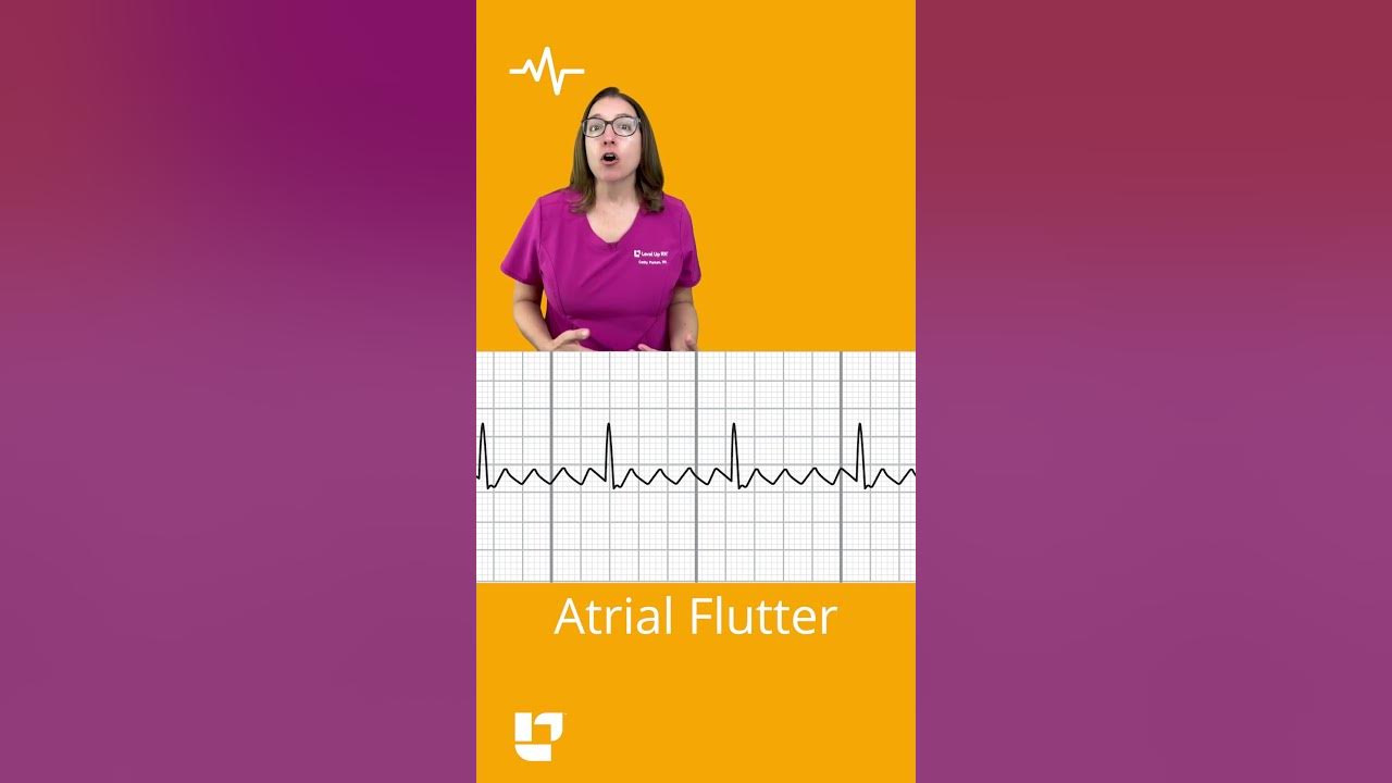 Difference between atrial fibrillation and atrial flutter F - YouTube