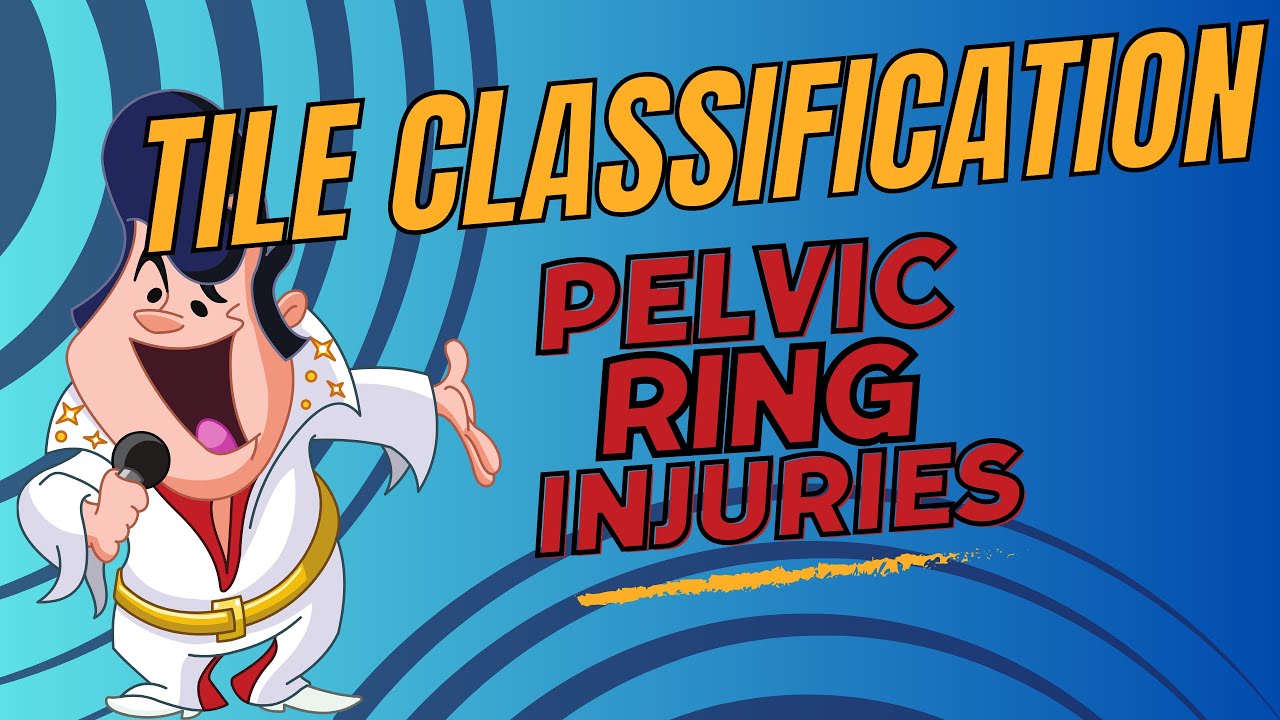 OrthoConcepts - Tile classification for Pelvic Fractures - YouTube