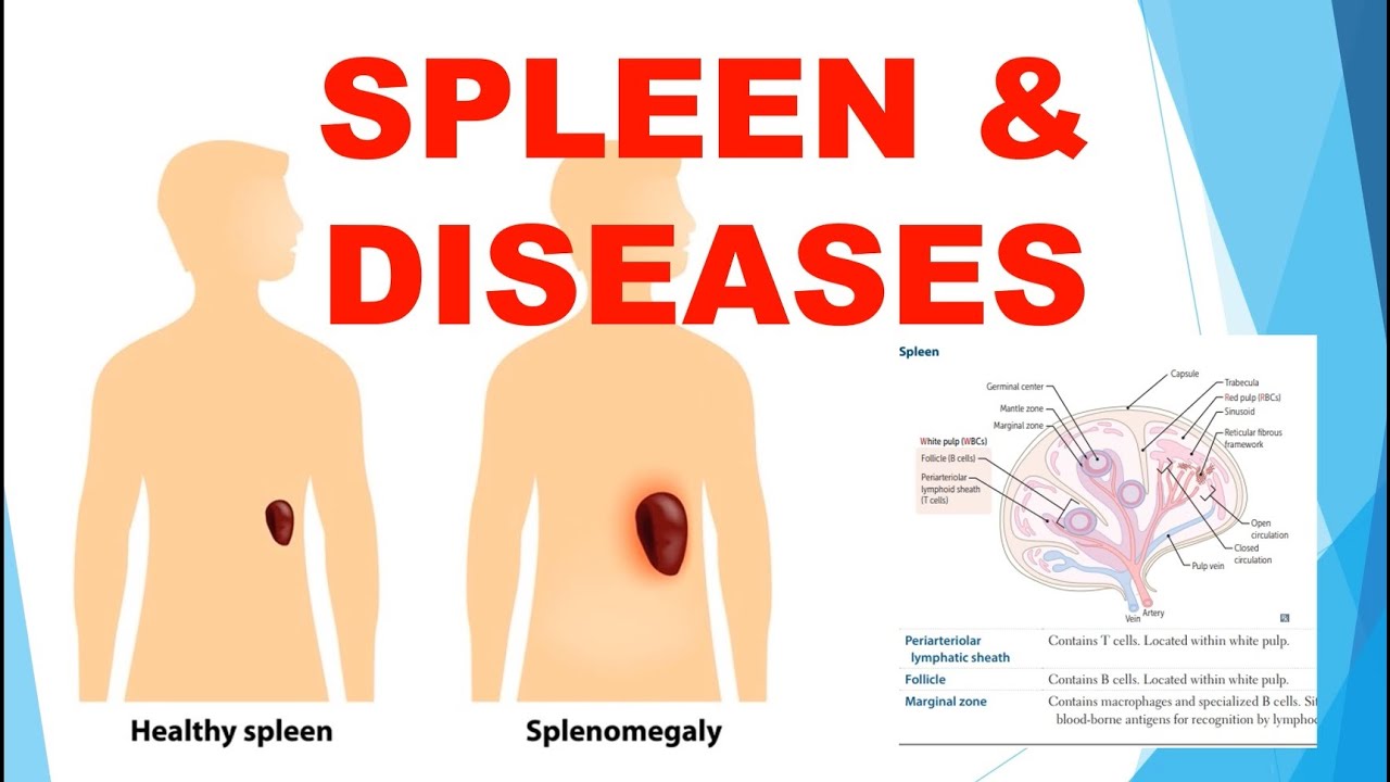 USMLE Step 1 Immunology SPLEEN & DISEASES with 20 USMLE Step 1 questions. - YouTube