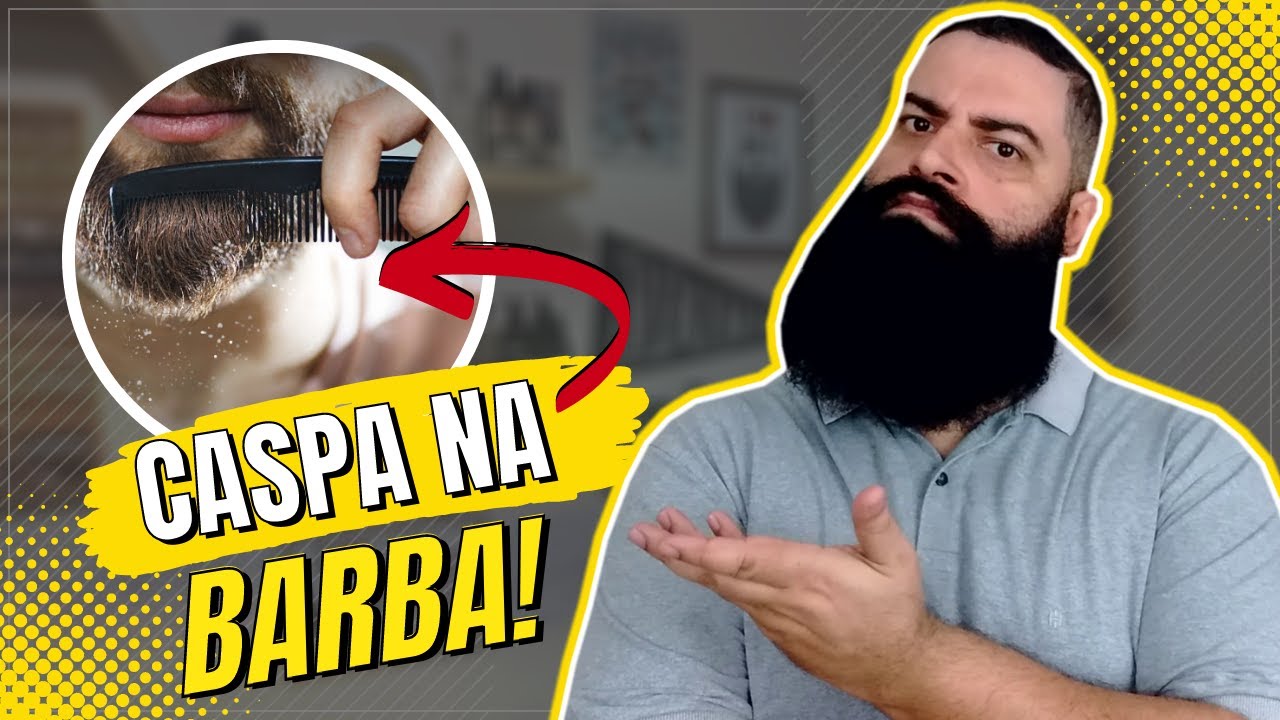 CASPA NA BARBA – Quais as Causas e Como Evitar Este Problema! - YouTube