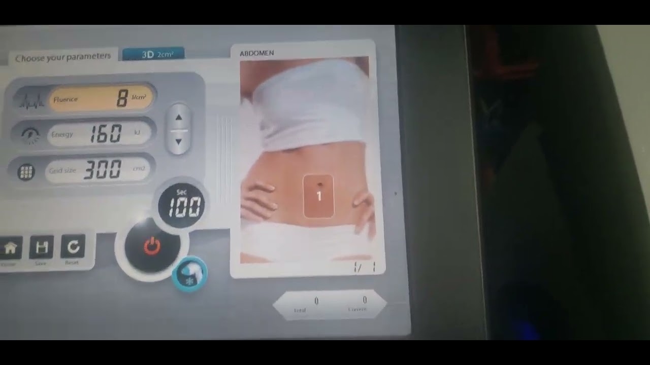 P4L 56232, Ageless Beauty - Soprano Platinum Rebuild - YouTube