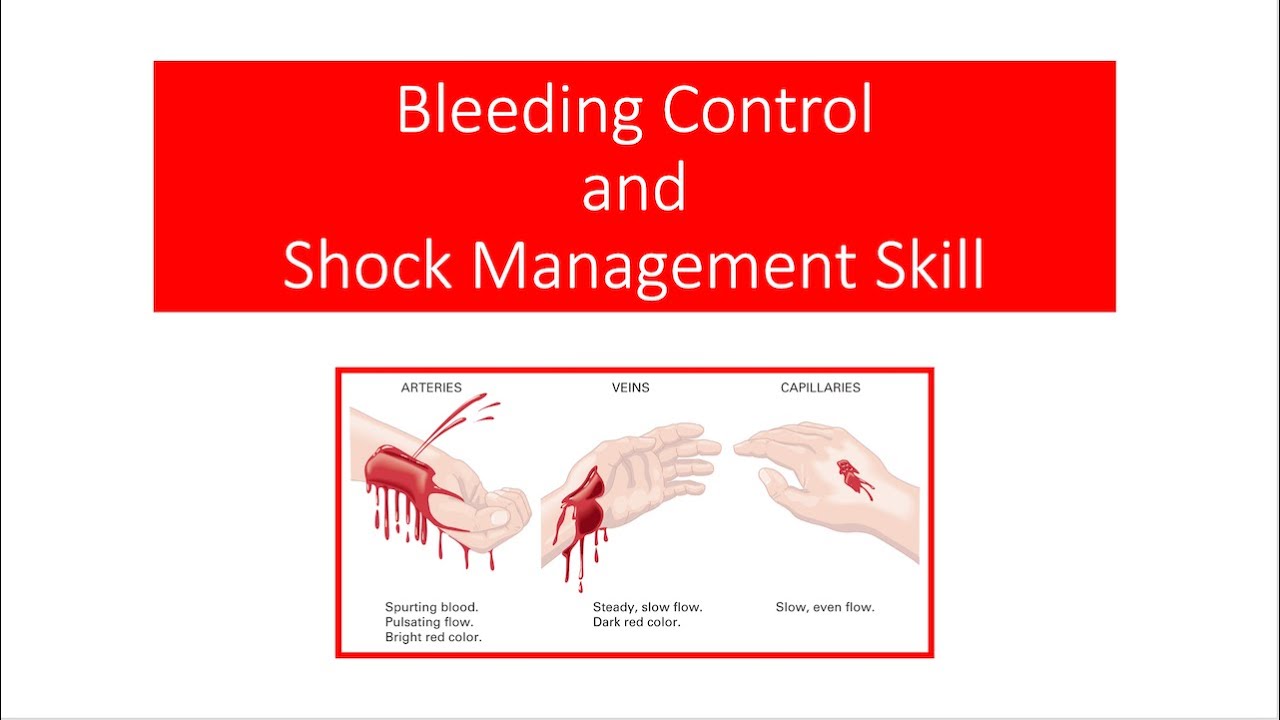 Bleeding Control / Shock Management Skill - YouTube