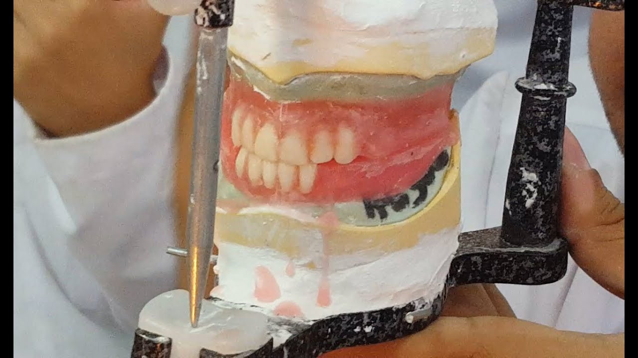 Setting Anterior upper and lower teeth - MUST - YouTube