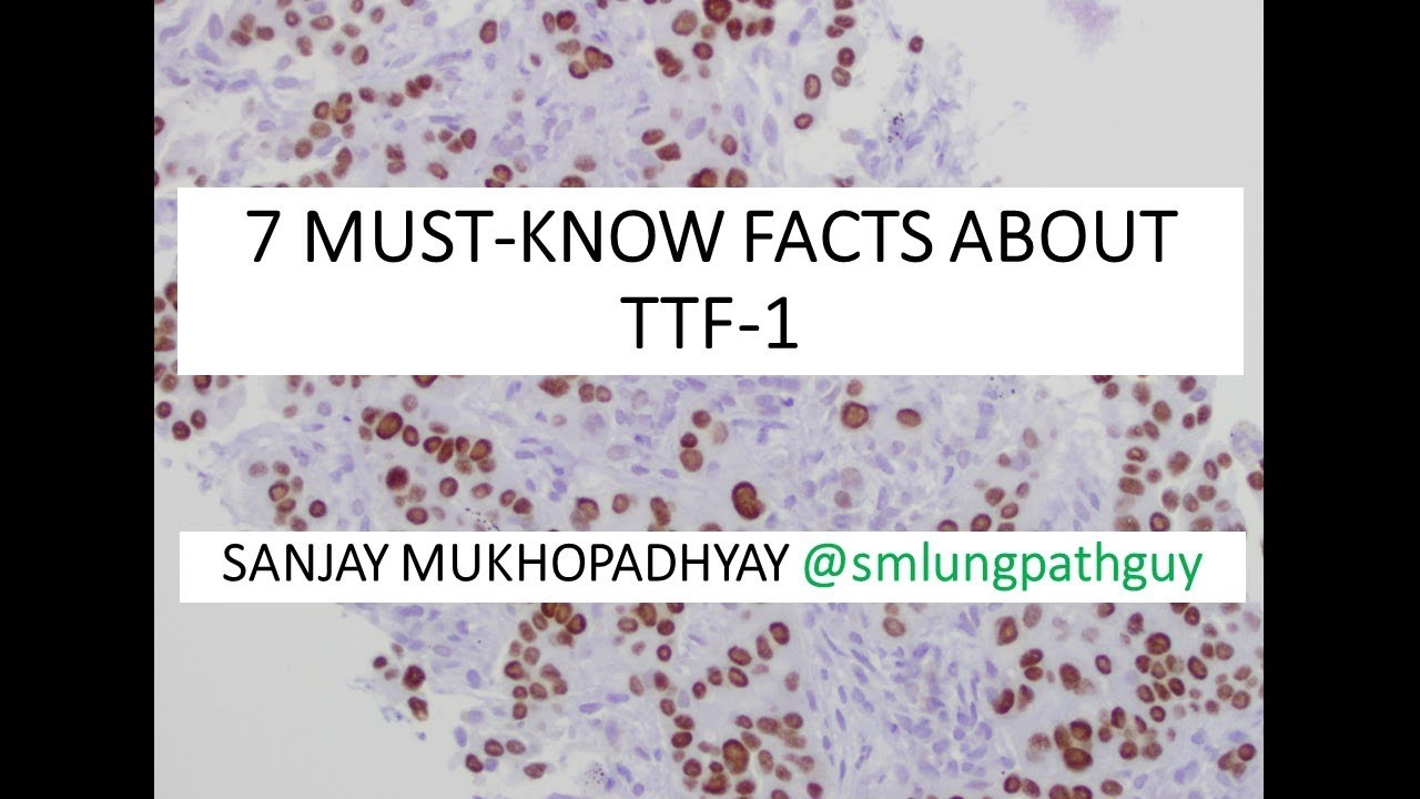 7 must-know facts about TTF -1 - YouTube