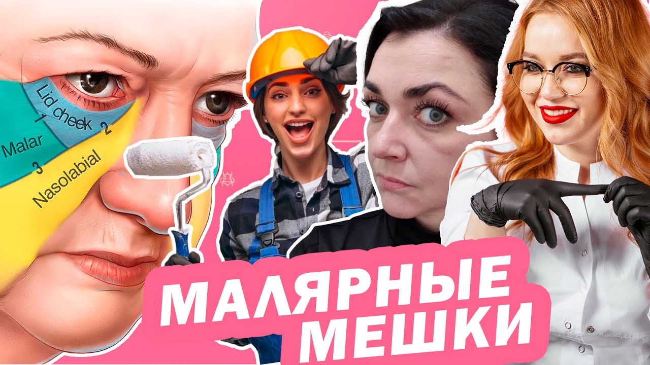 МАЛЯРНЫЕ МЕШКИ что это причины и как ИЗБАВИТЬСЯ Youtube