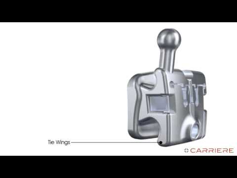 The Carriere System Self Ligating Bracket - YouTube