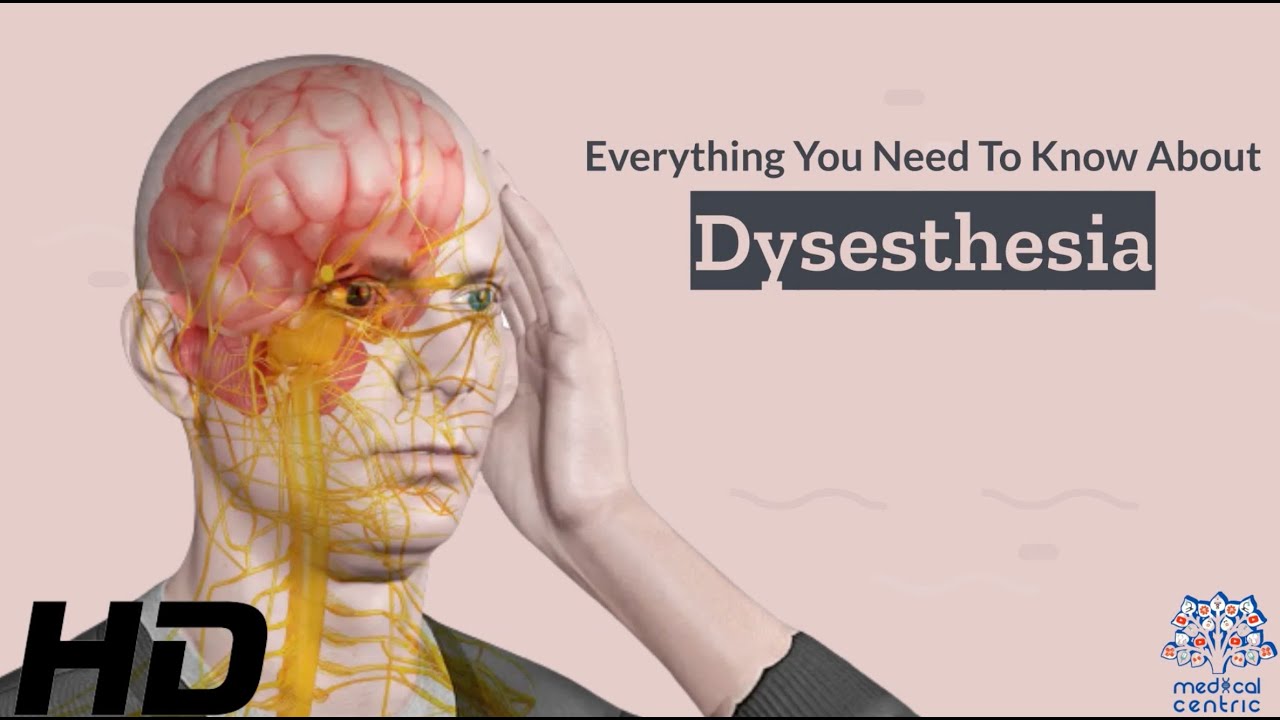 Dysesthesia 101: A Comprehensive Guide to this Mysterious Condition ...