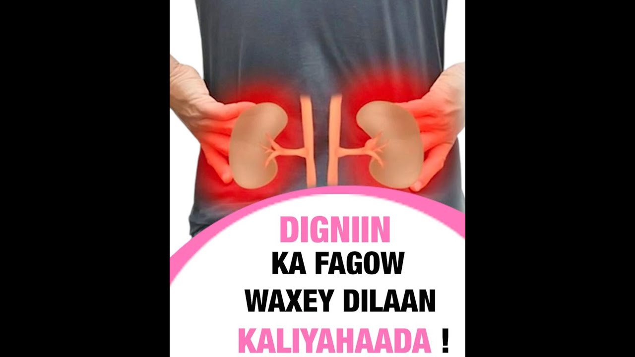 𝐃𝐈𝐆𝐍𝐈𝐈𝐍 KA FOGOW WAXYAABAHAAN WAXEY DILYAAN 𝐊𝐀𝐋𝐈𝐘𝐀𝐇𝐀𝐀𝐃𝐀. - YouTube